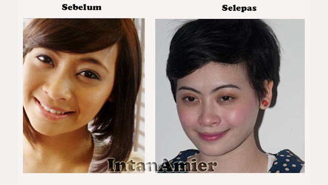 Beutskin Essence-Rahsia Kecantikan Kulit Adira Af7 Terbongkar