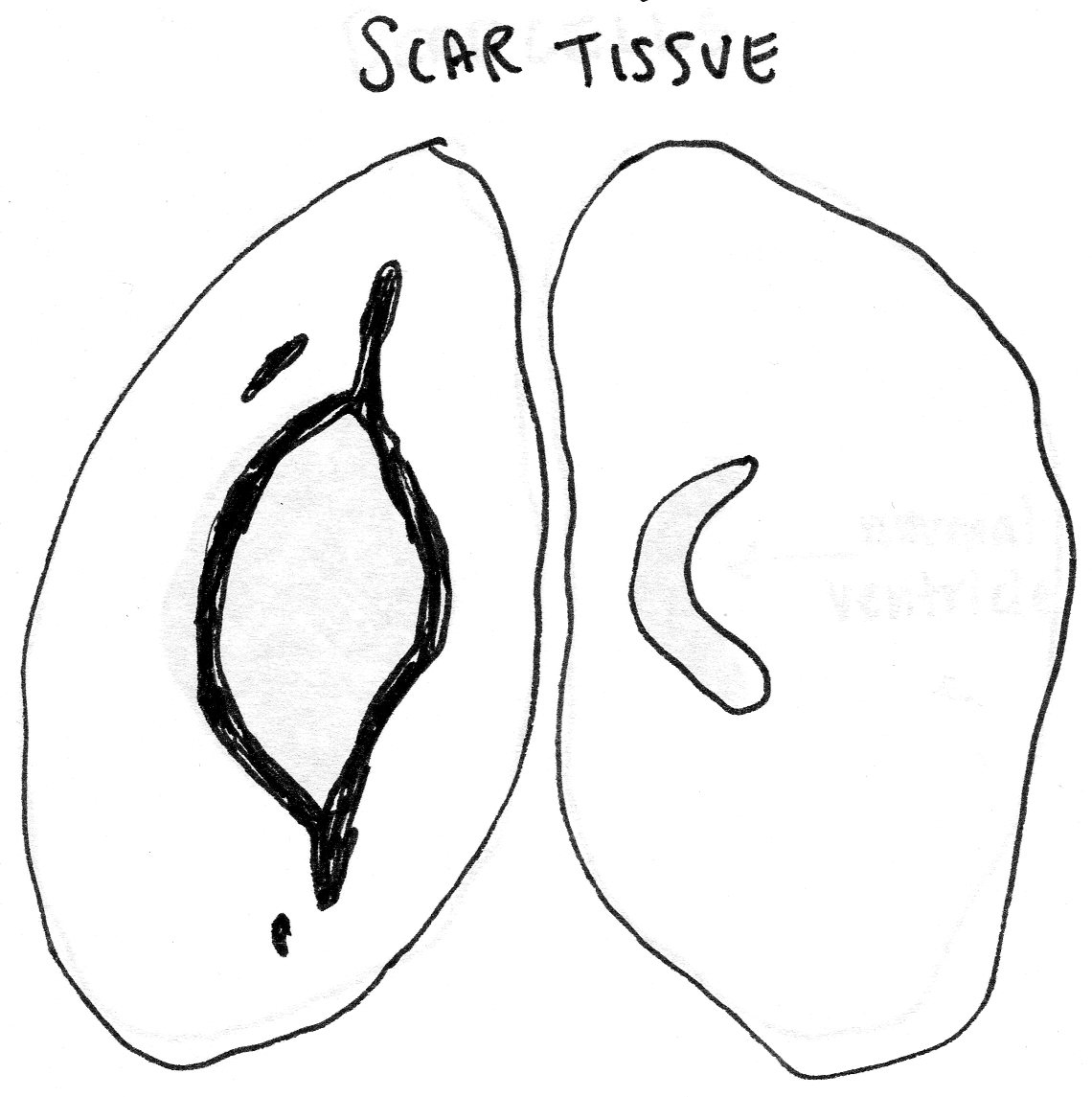 Help Charlie Heal: MRI Report