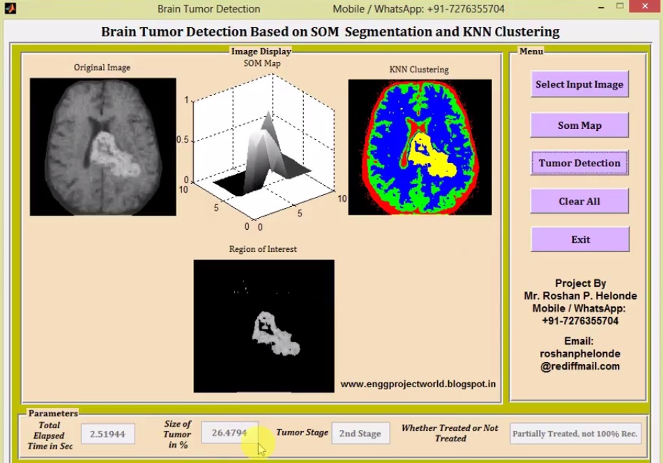 Brain Tumor Detection Using Som Segmentation And K Clustering Matlab Project With Source Code