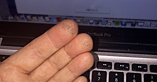 Diabetesaliciousness © 2007 - 2022: Diabetes, Pointing Fingers And ...