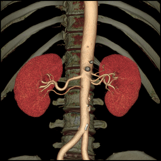 CROSS-SECTIONAL IMAGING EDUCATION HUB: CT Angiography ...Understanding ...