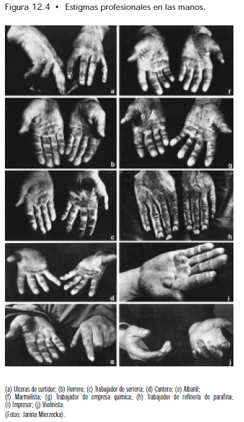 ESTIGMAS* (II) | Salud y Seguridad Industrial