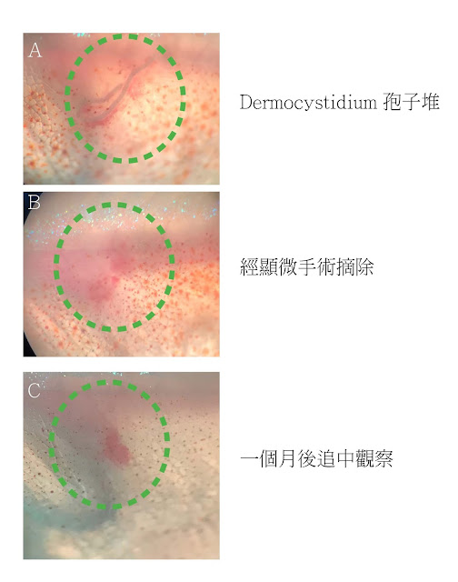 Hite's fish world: Dermocystidium 顯微手術摘除後觀察