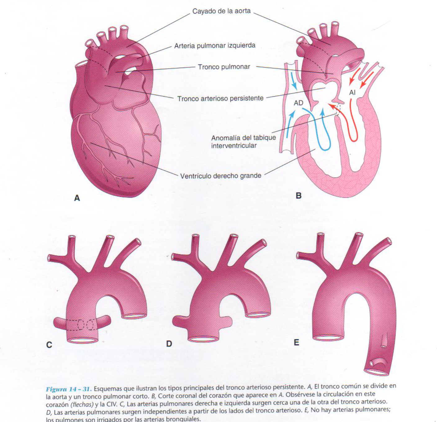 ESBOZOS MÉDICOS: ANOMALÍAS EMBRIOLÓGICAS APARATO CARDIOVASCULAR