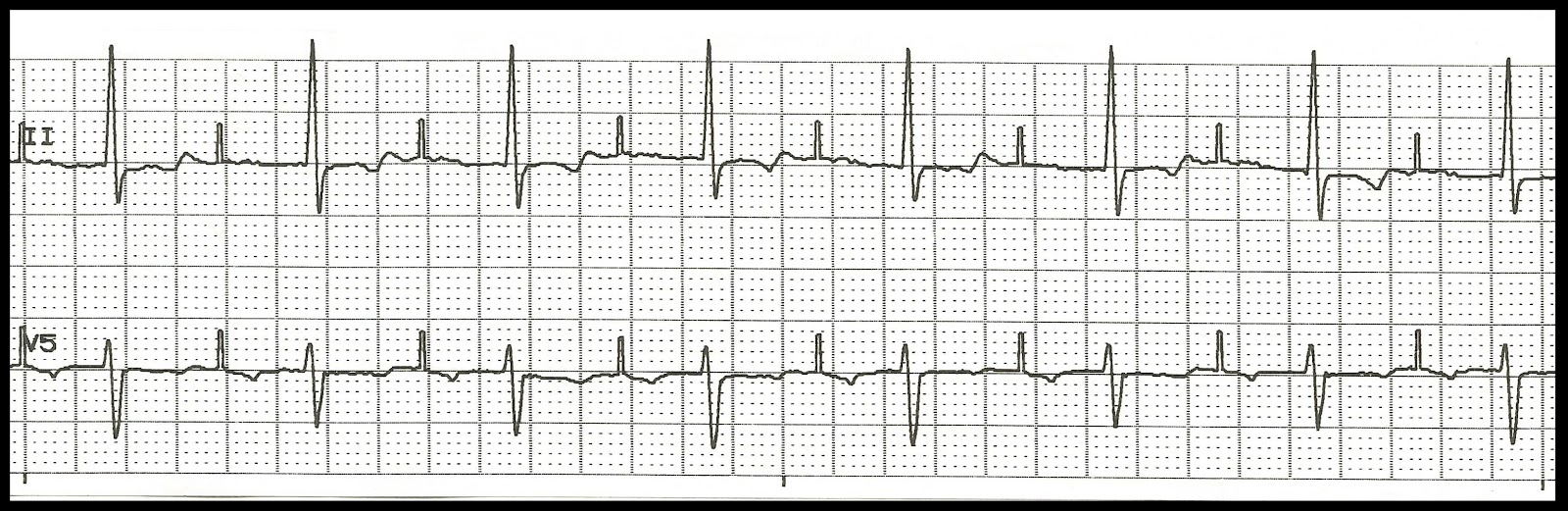 Basic EKG Rhythm Test 06