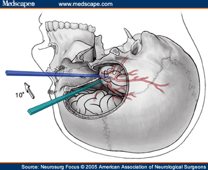 Ten Things That I Learned Today