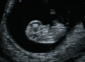 GINECOOBSTETRICIA 110 ECOGRAFIA: Pasos para la realización de la ...