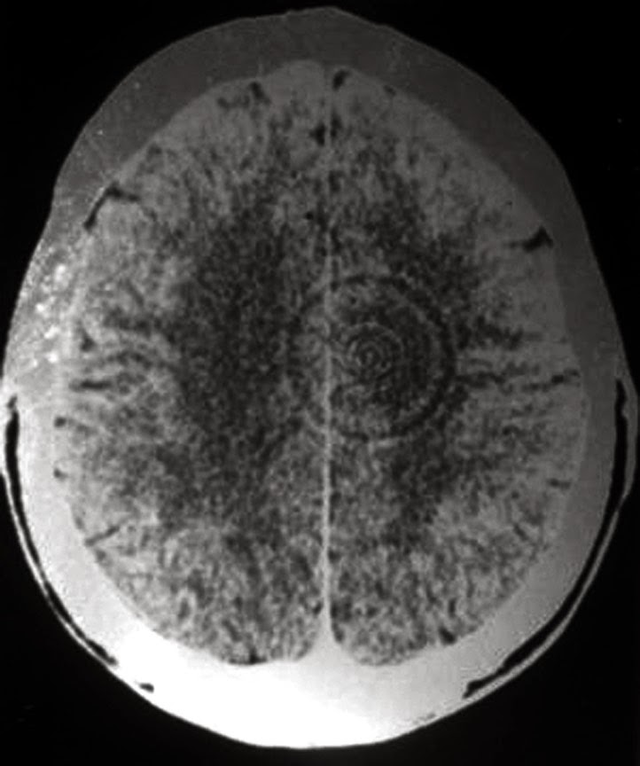 Ryke Geerd Hamer: Νέα Γερμανική Ιατρική | Καταρρίπτοντας την Ψευδοεπιστήμη