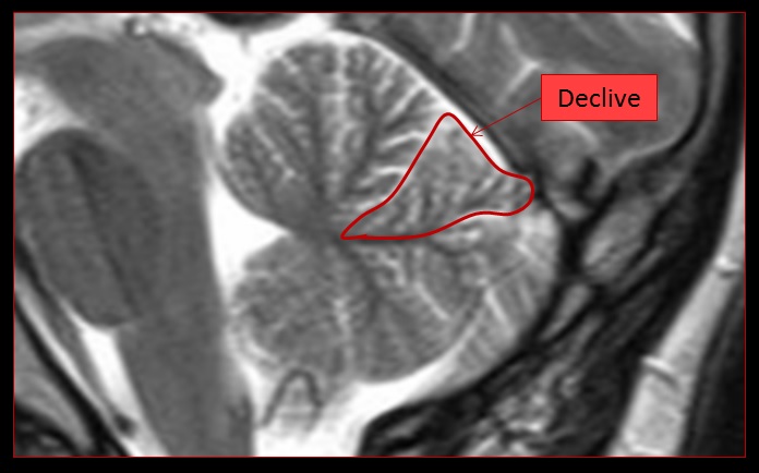 LABORATORIO DE IMÁGENES: 2017