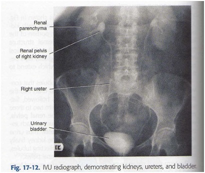 Rainbow: TEKNIK PEMERIKSAAN BNO IVP/ IVU