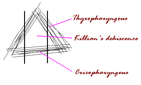 MedicoNotebook: Esophageal diverticulum