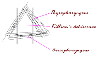 MedicoNotebook: Esophageal diverticulum