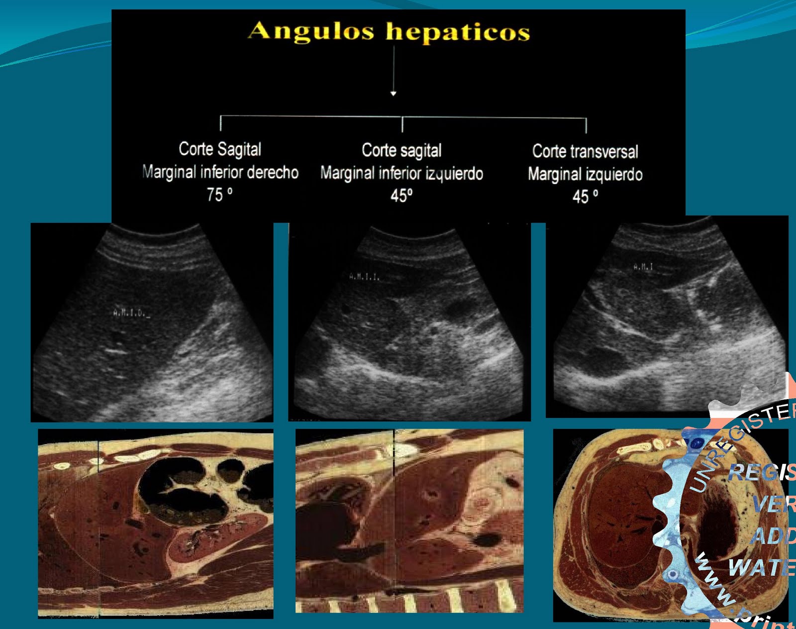 Diagnóstico Ecográfico en la Urgencia- Santojanni: Ecografía Hepática 2