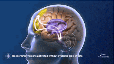 abril 2016 ~ LA NEUROPEDIATRIA Y SUS ENFOQUES EN LA CIRUGIA