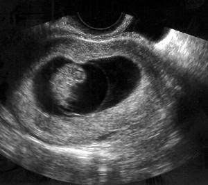 She and Me and Baby Makes Three. The Stories of Our Journey to Conceive ...