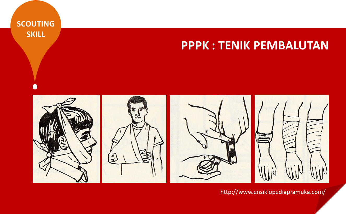 PPPK : Teknik Pembalutan