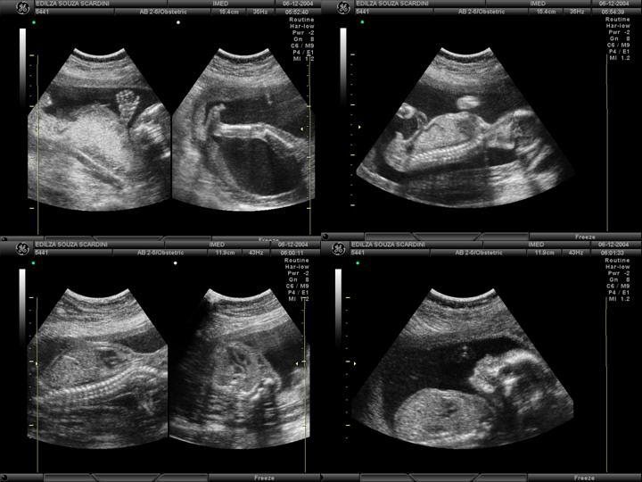 Enfermeiros Tecnológicos: ULTRA-SONOGRAFIA