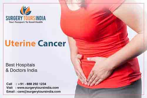 Guide About Endometrial/Uterine Cancer - global cancer surgery