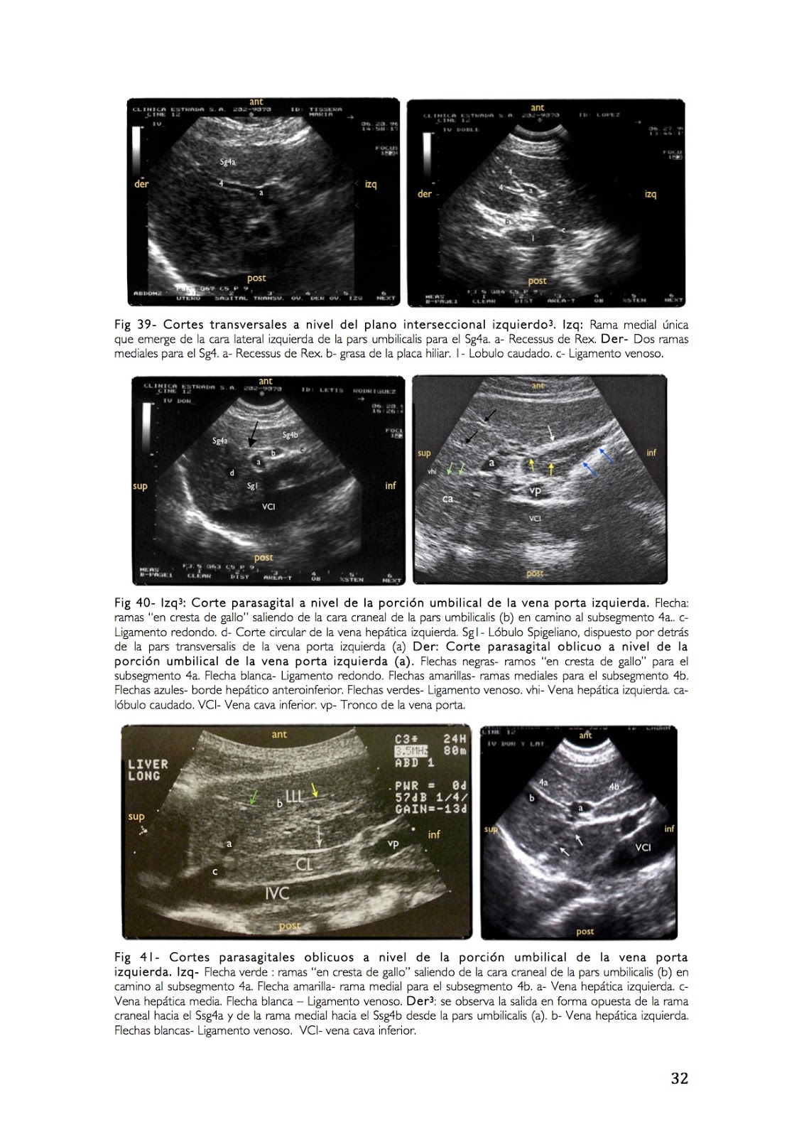 Cuadernos de Anatomía Quirúrgica: Anatomía ecográfica de las ramas ...