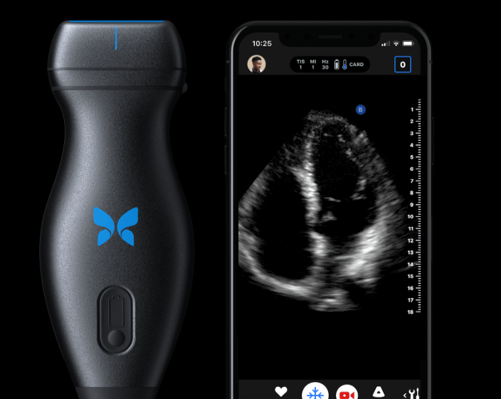 Ob/Gyn Updated : Ultrasound revisited–Personalized imaging anywhere ...