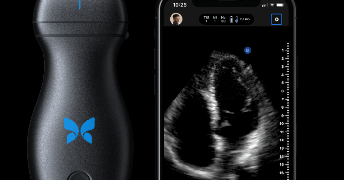 Ultrasonography Uses