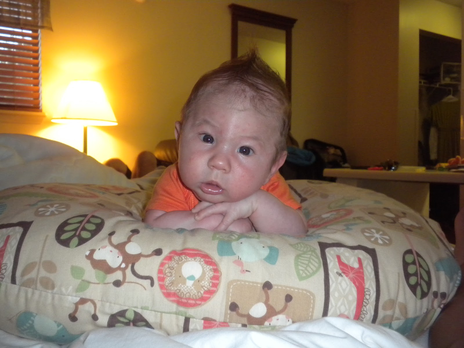 Metopic Craniosynostosis