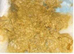 "Anjinho Lucas": "O cocô do bebê guia de imagens por BabyCenter do Brasil"