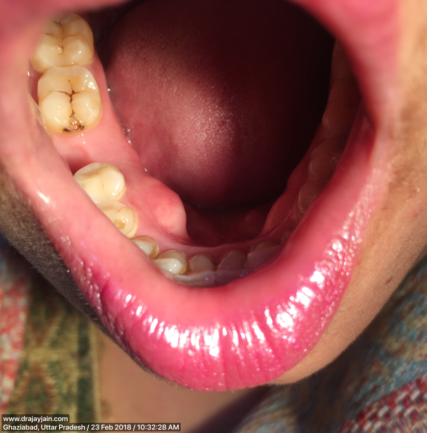 ENT Surgeon's blog: February 2018