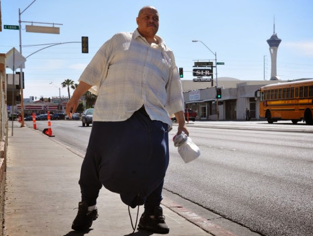 DALILI ZA UGONJWA WA BUSHA, ATHARI ZA UGONJWA WA BUSHA TIBA YA UGONJWA ...