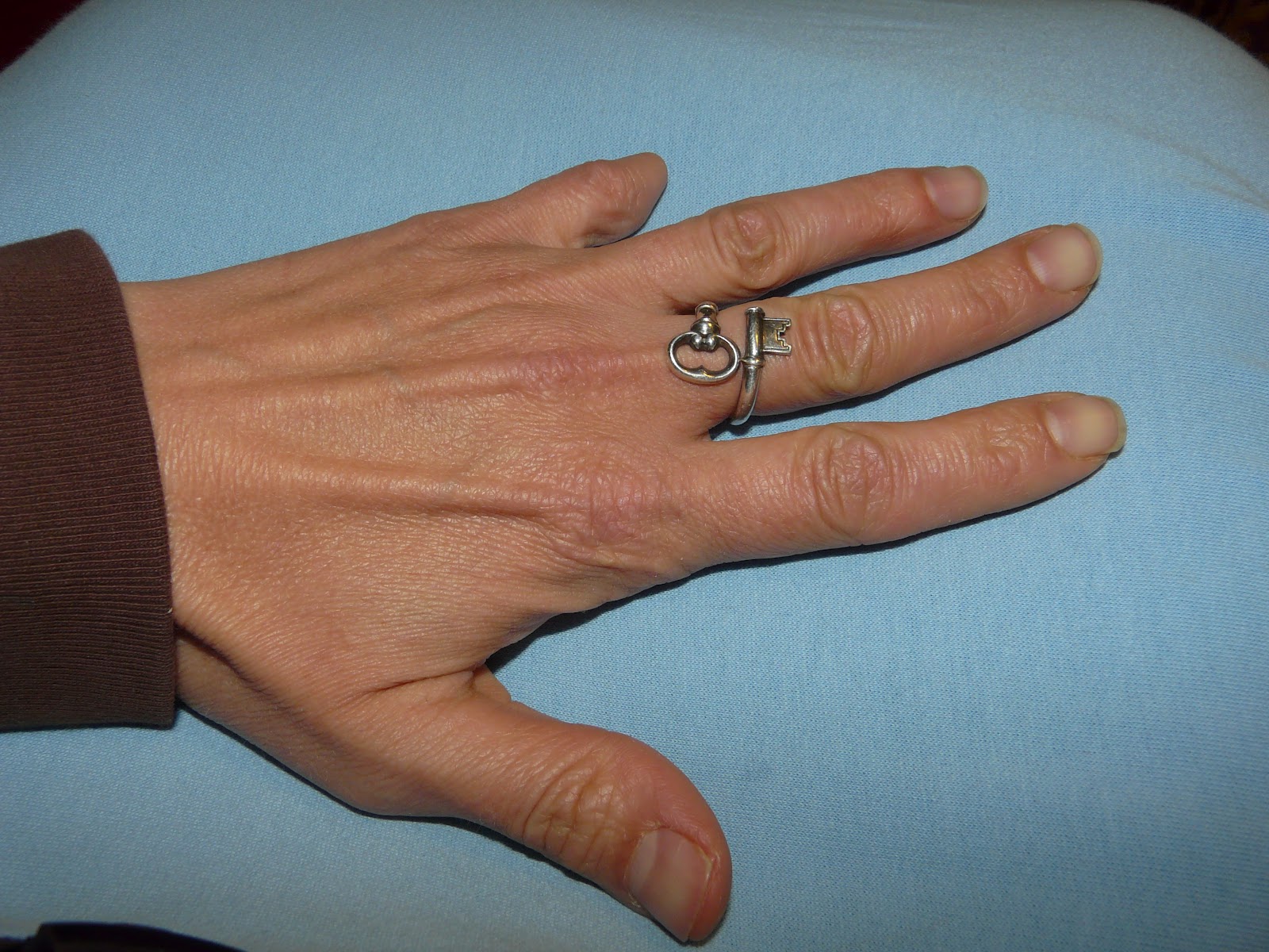 The "Secret" is Gratitude: Slide Safety - Loosing a Finger - Life ...