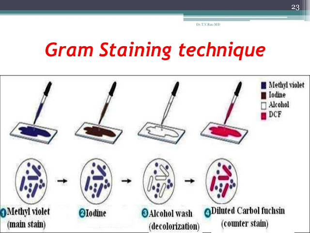 Gram staining