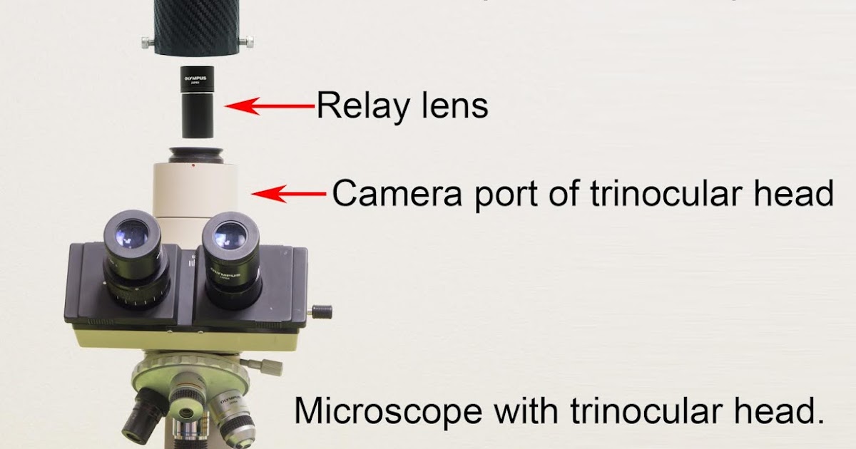 General explanation of Photomicrograph.