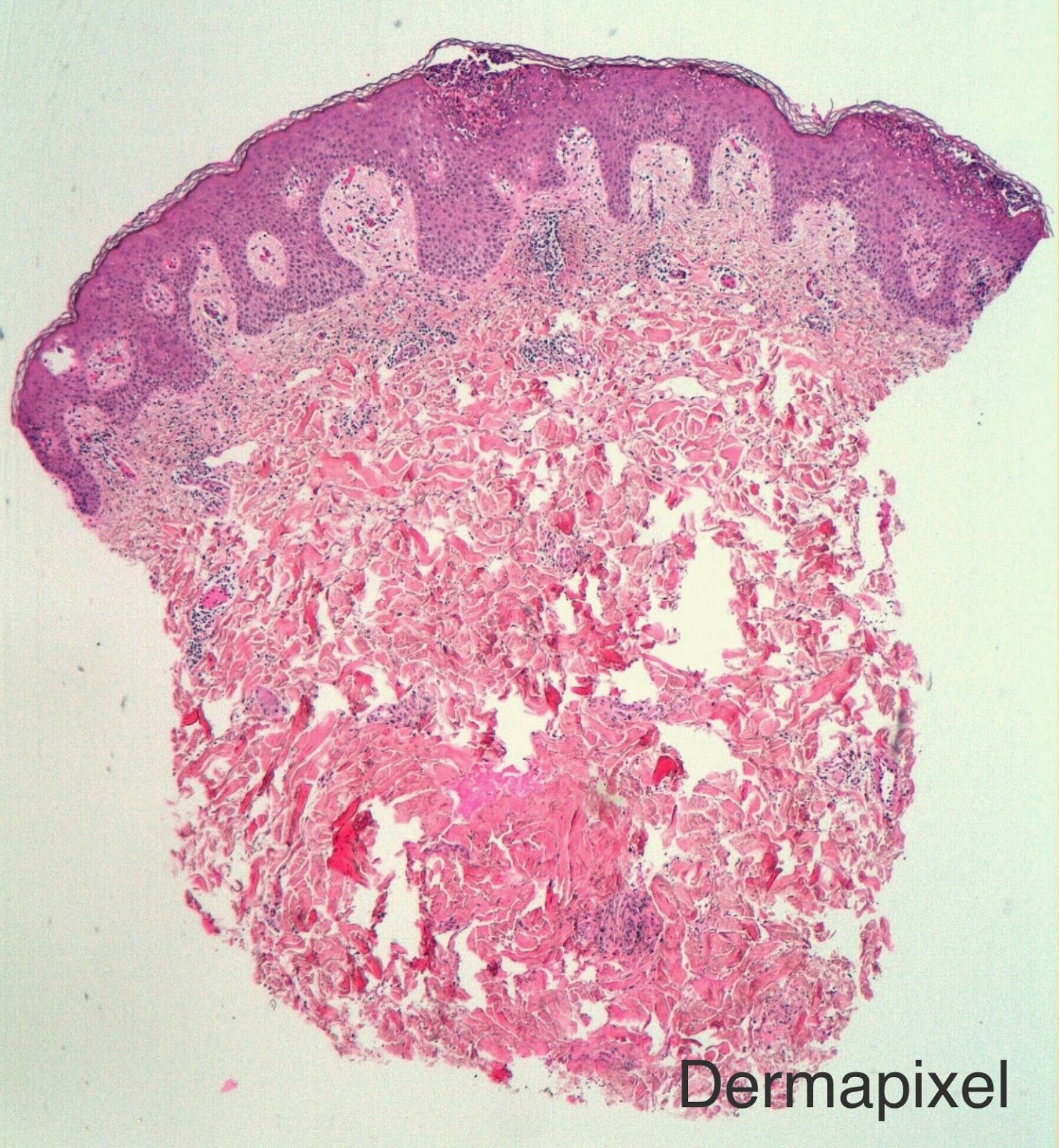 Dermapixel: febrero 2018