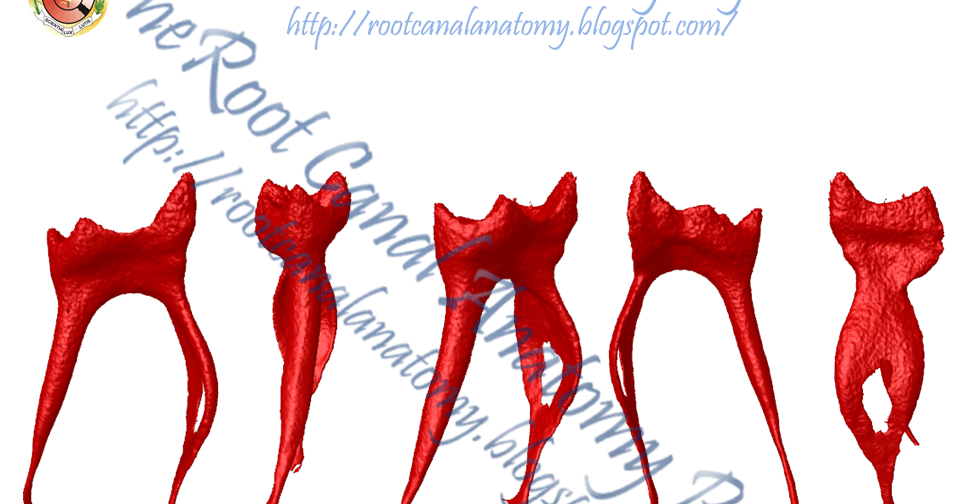 The Root Canal Anatomy Project: Mandibular First Molar