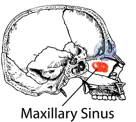 Nursing Diagnosis for Maxillary Sinusitis - IT News