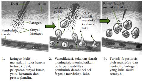 Sistem Pertahanan Tubuh - Pustaka Belajar
