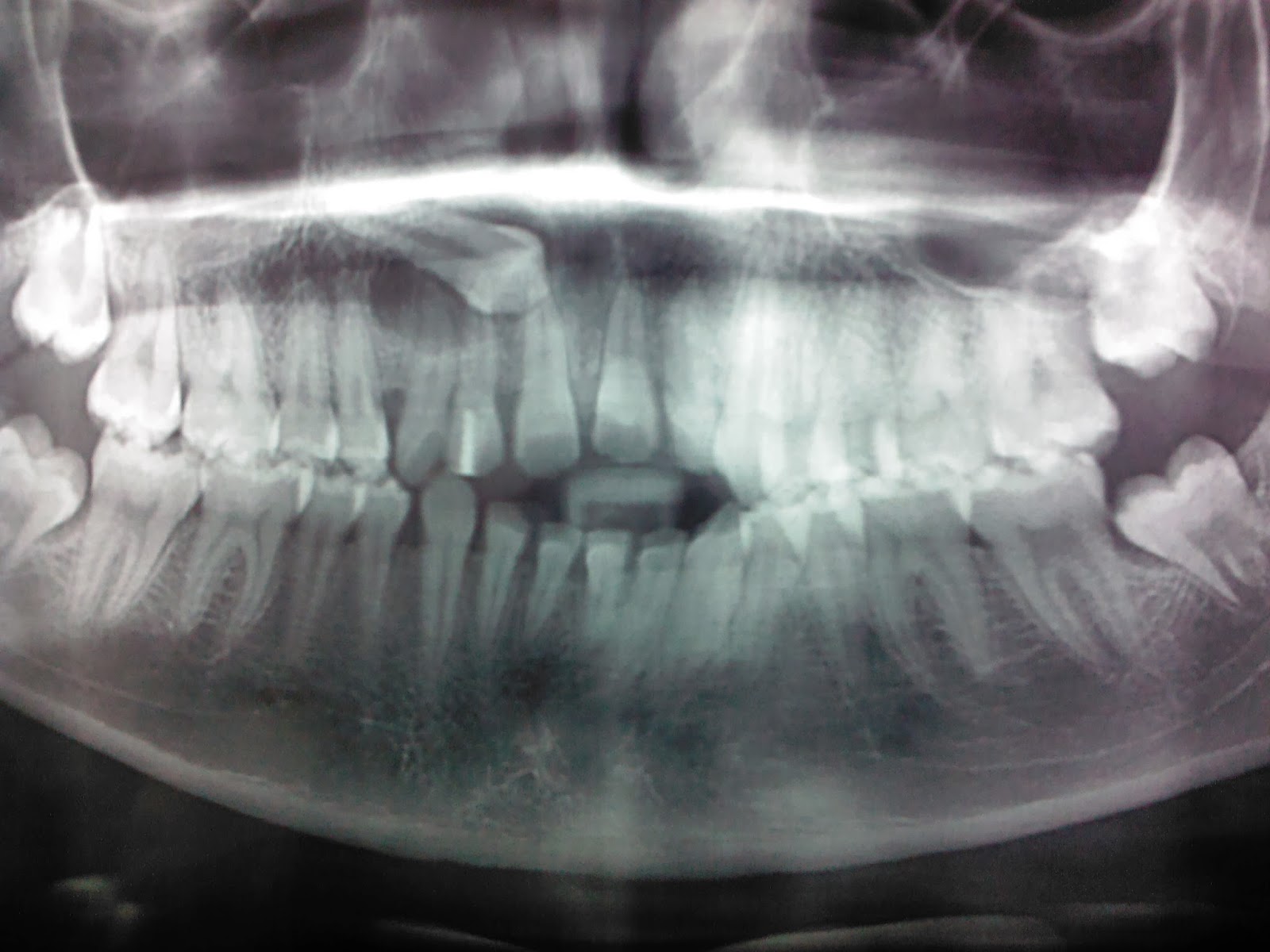 Cirurgia e Traumatologia Bucomaxilofacial