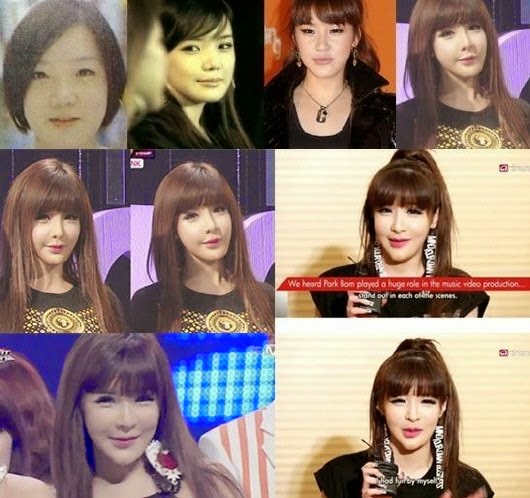 Korean celebrity before and after plastic surgery pictures - About ...