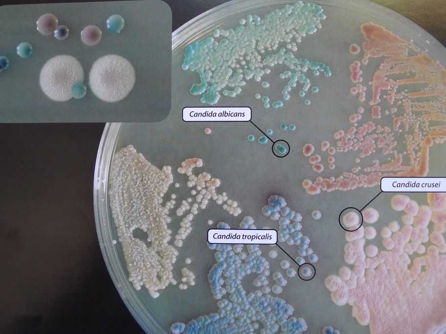 Z Mikrobiologią za Pan Brat: Candida albicans i inne grzyby drożdżopodobne