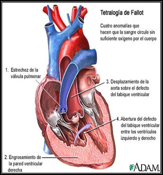 Patología: CORAZON