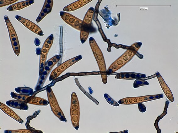 Fun With Microbiology (What's Buggin' You?): Exserohilum rostratum