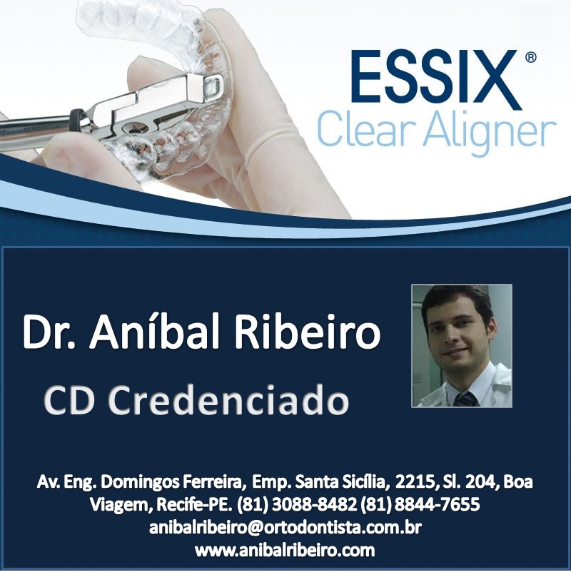 Anibal Ribeiro - Ortodontia: ESSIX Clear Aligner: tratamento estético ...