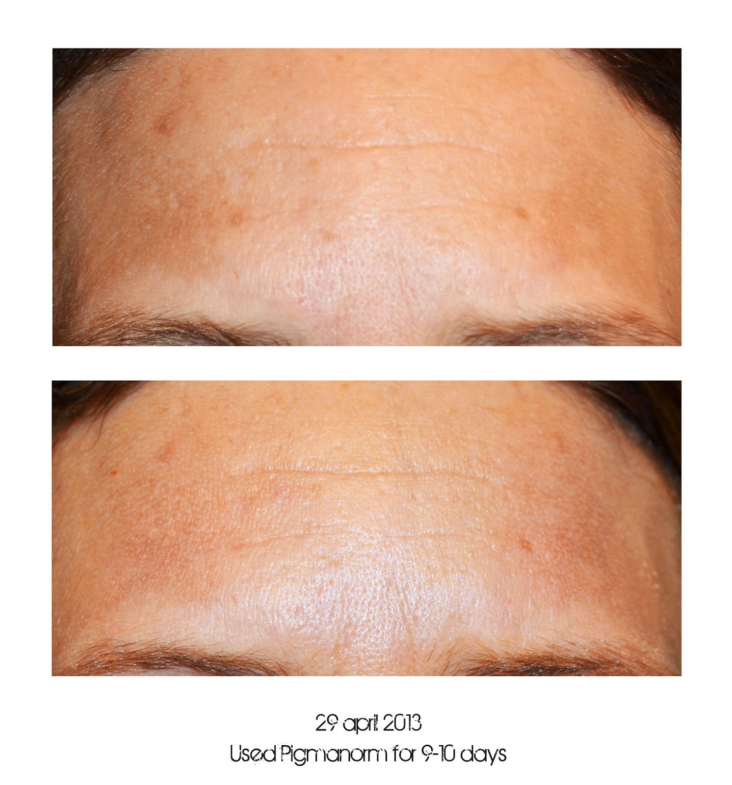 fightingmelasma.blogspot.com