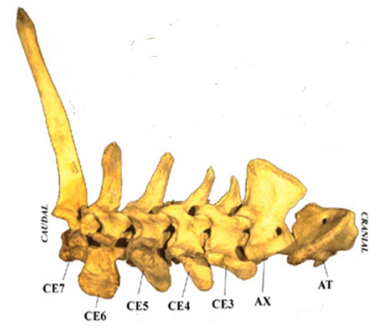 Catatan Kuliah-q: ANATOMI TULANG (Osteo Vertebra)