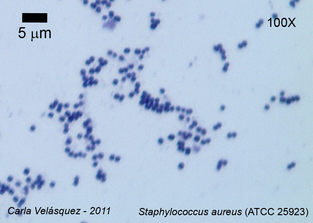 Bacterias al microscopio: Staphylococcus aureus