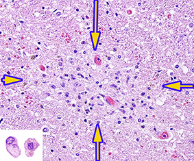 Le Cerveau de l'Enfant et de l'Adolescent: La Microglie