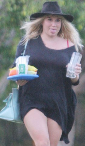 Oh dear! What happened to singer Kesha? (photos)