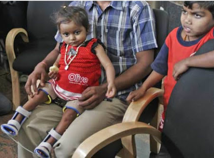 Four armed and legged girl | Interesting Things