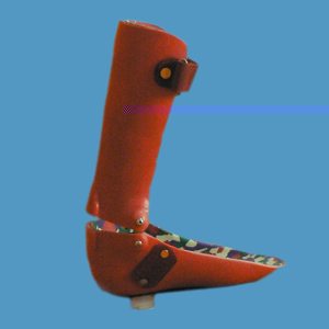 ortopedik protez ve ortez: Ortez