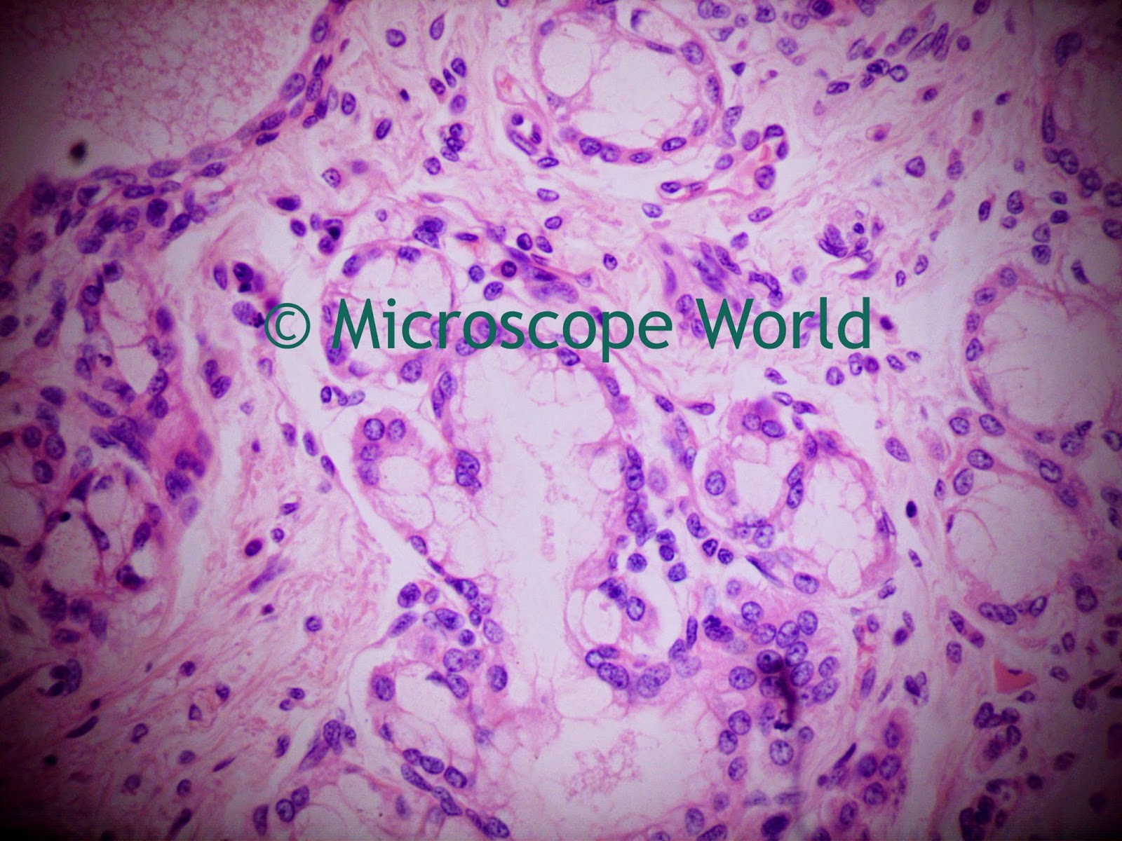 Microscope World Blog: Human Esophagus Under the Microscope
